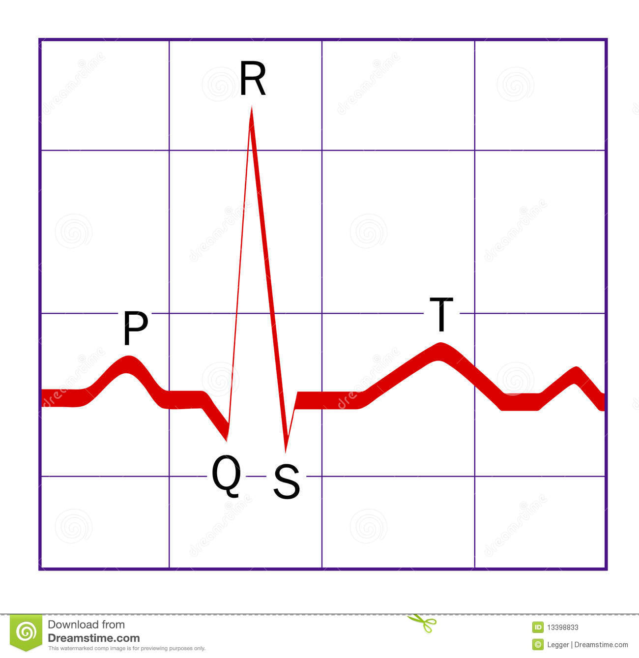 Ecg Drawing at PaintingValley.com | Explore collection of Ecg Drawing
