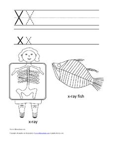 X Ray Drawing Kindergarten at PaintingValley.com | Explore collection ...